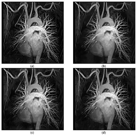 entropy free full text an entropy based algorithm with nonlocal residual learning for image