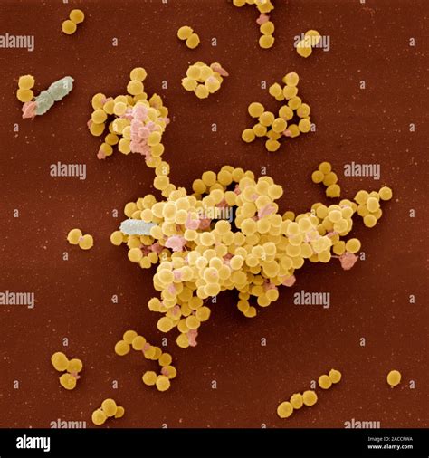 Staphylococcus Aureus Bacteria Coloured Scanning Electron Micrograph