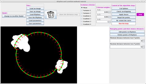 image segmentation