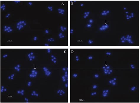 Detection Of Apoptotic And Normal Cells By Dapi Staining A Cells Download Scientific Diagram