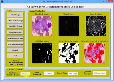 Blood Cancer Detection Using Image Processing Matlab Code The Meta