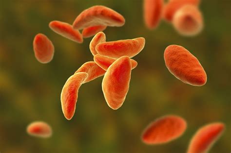 Toxoplasmose Was Sich Dahinter Verbirgt Und Wie Man Sich Sch Tzt