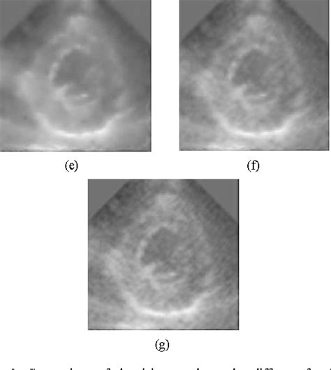 figure 2 from a fractional order primal dual denoising algorithm semantic scholar