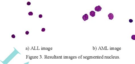 figure 3 from classification of acute leukaemia cells using multilayer perceptron and simplified