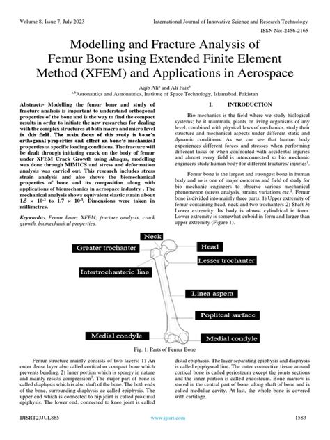 modelling and fracture analysis of femur bone using extended finite element method xfem and