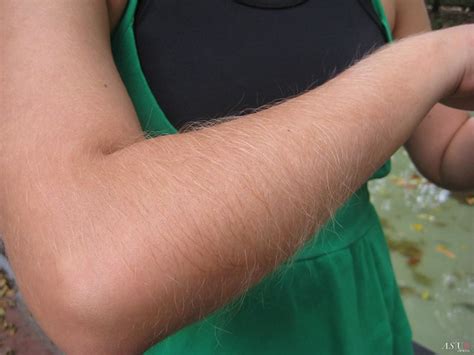 Girls With Hairy Arms Flickr