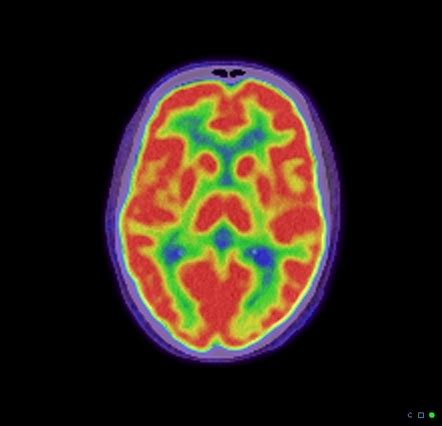Pet Brain