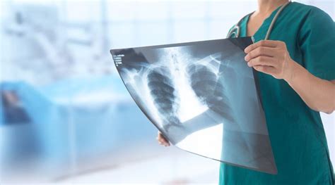 X Ray Vs CT Scan Whats The Difference Superior Urgent Care