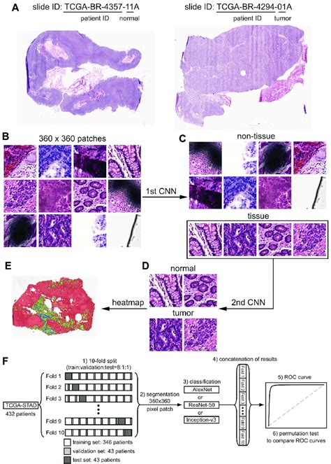 work flow of a fully automated tissue classifier for whole slide images download scientific