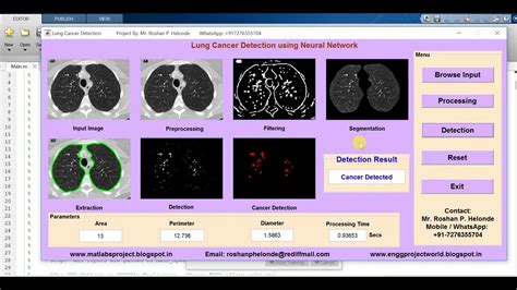 lung cancer detection using neural network matlab project with source code youtube