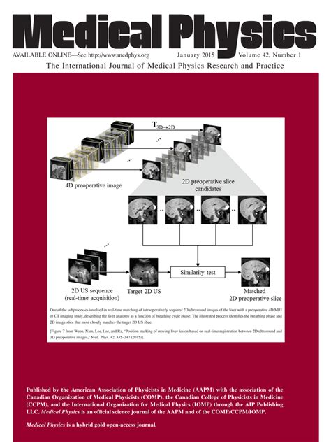 assessment of the dose reduction potential of a model‐based iterative reconstruction algorithm