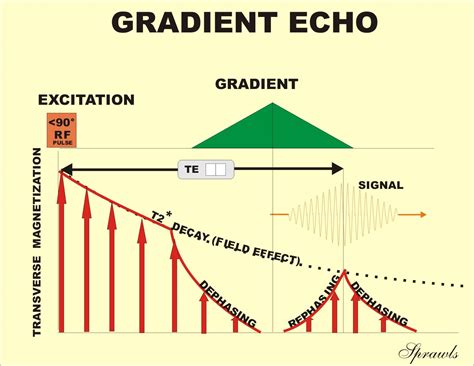 magnetic resonance imaging
