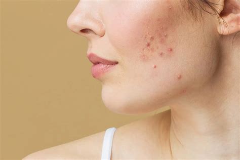 Signs You Need To See A Dermatologist Totes Newsworthy