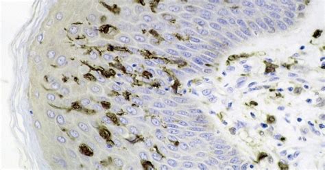 Dendritic Cells What Are They Characteristics And Functions In The Body