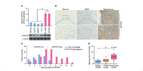 SAPCD2 Is Upregulated In Fibrosarcoma Tissues And Cells A