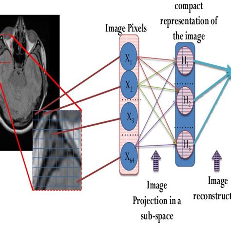 pdf an enhencment medical image compression algorithm based on neural network