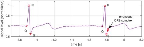 ecg based biometric authentication free projects