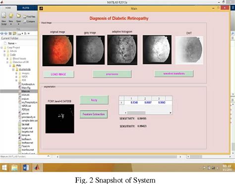 figure 1 from detection of diabetic retinopathy using image processing and machine learning