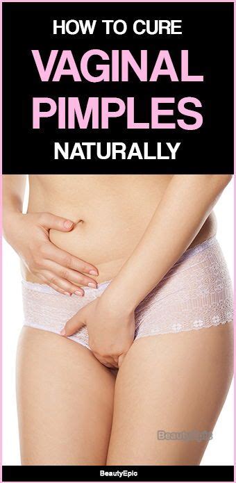 What Causes Pimples Artofit