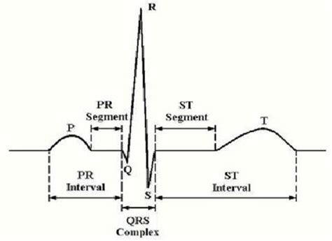 figure 1 from ecg denoising using weiner filter and adaptive least mean square algorithm