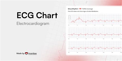 Electrocardiogram ECG Chart Figma