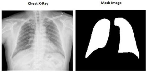 technologies free full text deep neural network for lung image segmentation on chest x ray