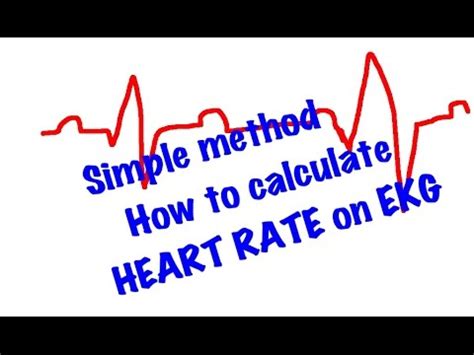 EKG ECG Made Simple Easy How To Calculate Heart Rate Very Easy