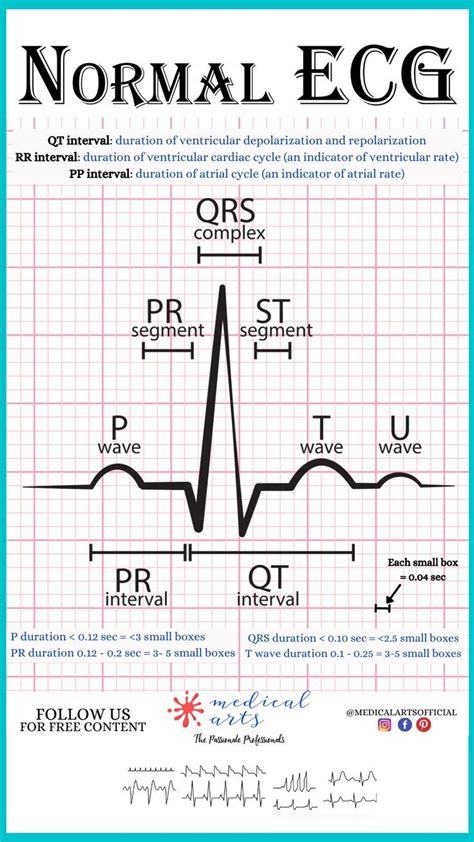 Normal ECG Cheatsheet Explains The Mechanism Of PQRST Helps Calculate