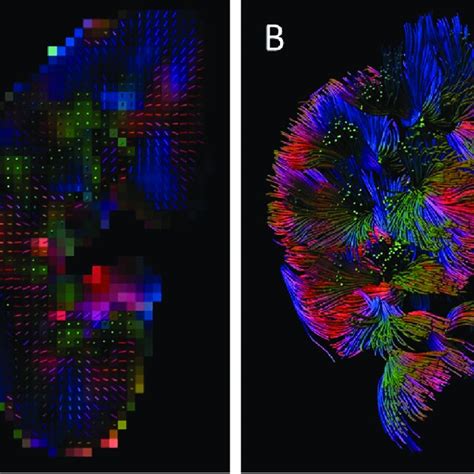 5 Diffusion Tensor Imaging And Tractography In The Kidney A Lines