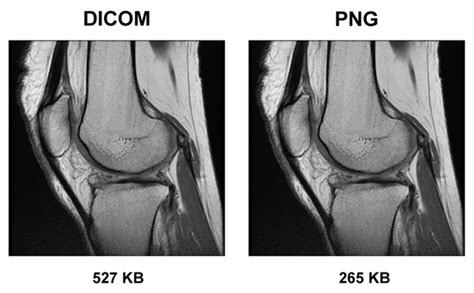 lossless compression medical imaging compression