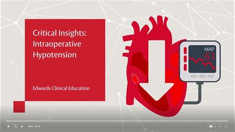 critical insights intraoperative hypotension youtube