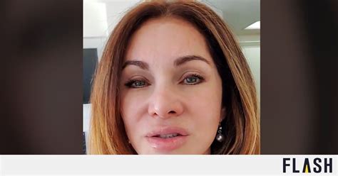 Tiktoker έκανε Botox στο πρόσωπο για 20 χρόνια Πώς είναι τώρα που σταμάτησε