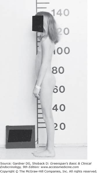 Kallmann Syndrome Nude Telegraph