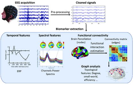 A Schematic Representation Of EEG Signal Processing Workflow And
