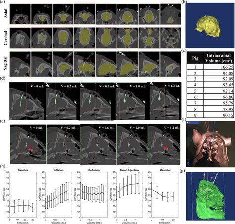 computed tomography imaging integration and precise capture of evolving download scientific