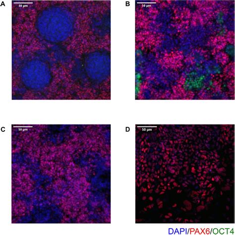 Differentiation Of Human Induced Pluripotent Stem Cells Into Cortical