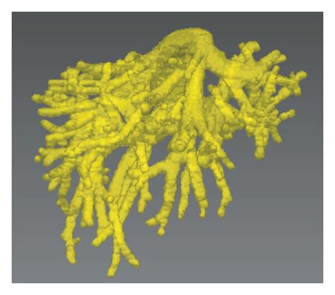 comparison of the improved fuzzy connectedness fc method with download scientific diagram
