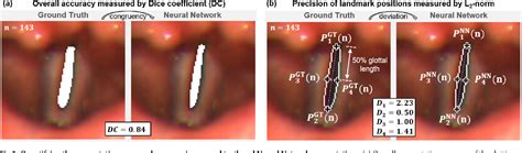 figure 3 from fully automatic segmentation of glottis and vocal folds in endoscopic laryngeal