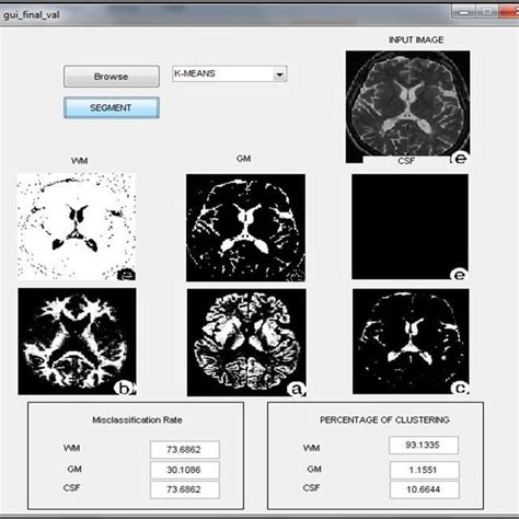 gui for segmentation of brain using hybrid fuzzy k means download scientific diagram