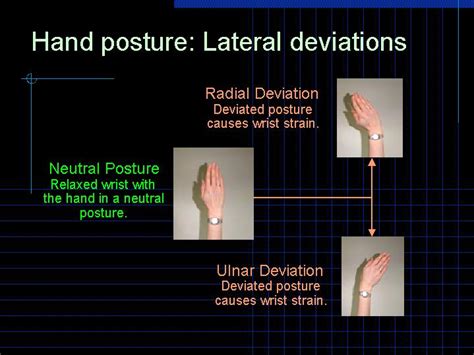 hand posture lateral deviations