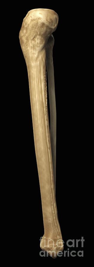 Tibia And Fibula Photograph By Science Picture Co