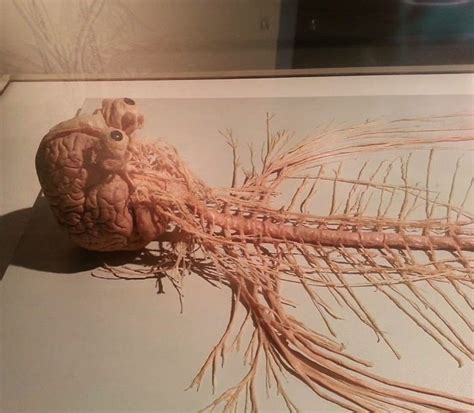 The Dissected Human Nervous System Surgery MedicalTalk Net The