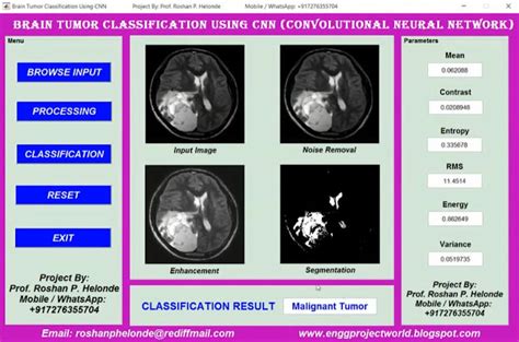 brain tumor detection using convolutional neural network matlab project with source code brain