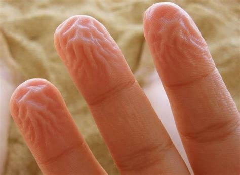 Why Is The Bottom Of My Feet So Wrinkly At Kenneth Talley Blog