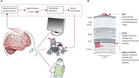 brain computer interfaces in neurological rehabilitation the lancet neurology