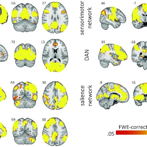 large scale intrinsic connectivity brain networks patterns of download scientific diagram