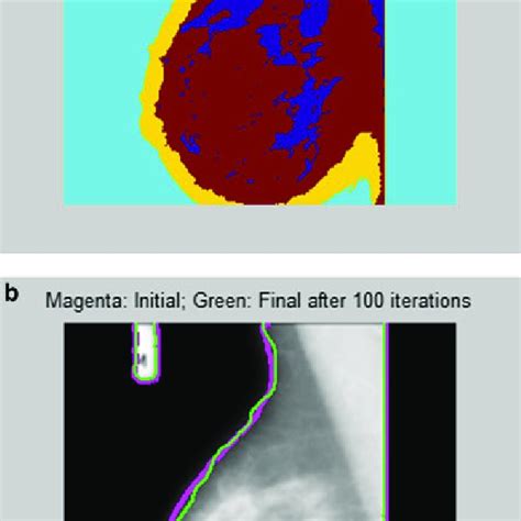 a image segmentation using k means clustering algorithm b segmentation download scientific