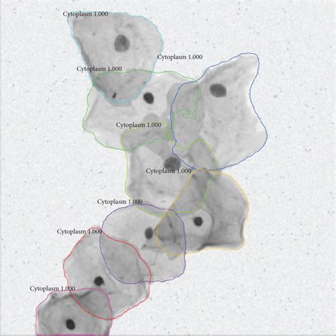 example of segmentation of a cytology image a the original download scientific diagram