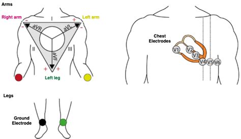 diagnostics free full text interpretable machine learning techniques in ecg based heart