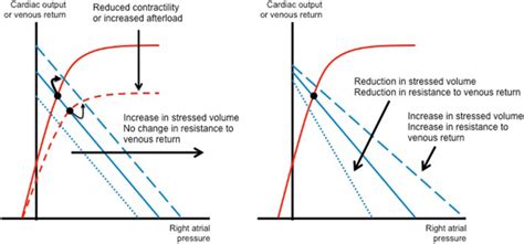 cardiac output and cvp are determined by the point of the intersection download scientific